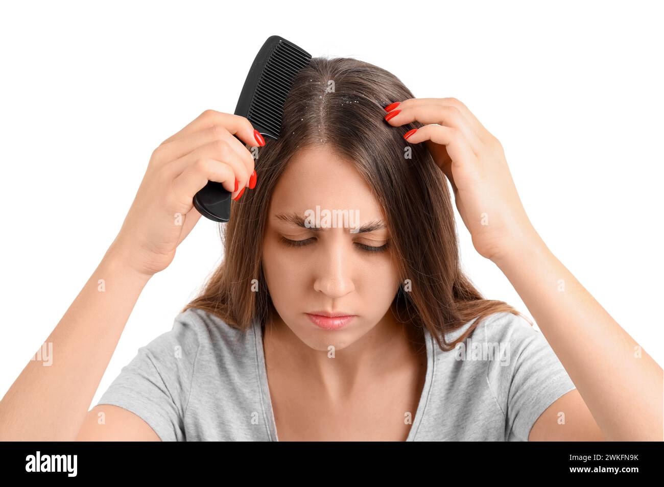Young woman with dandruff combing hair on white background Stock Photo ...