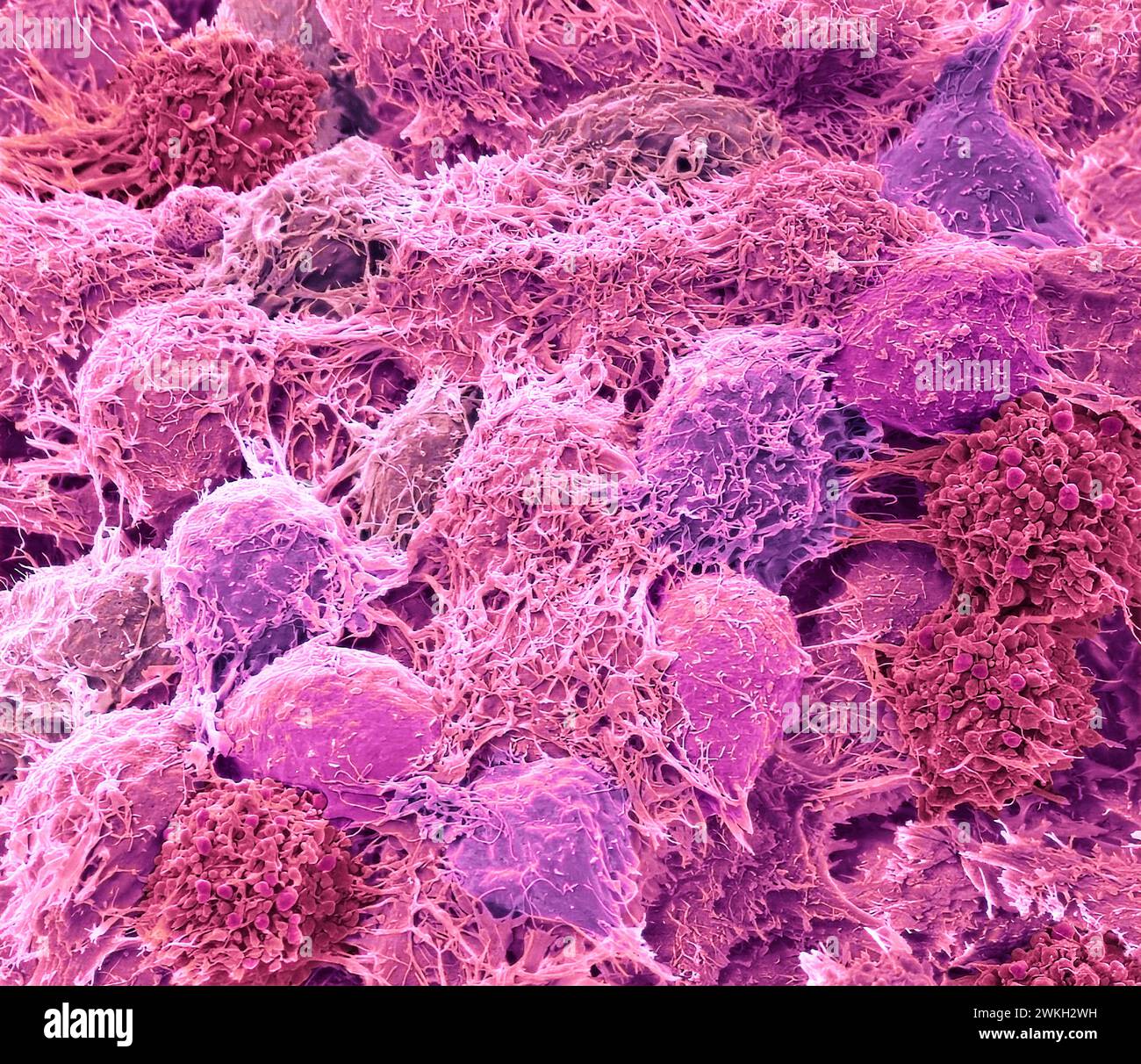 Hela cells, SEM Stock Photo - Alamy