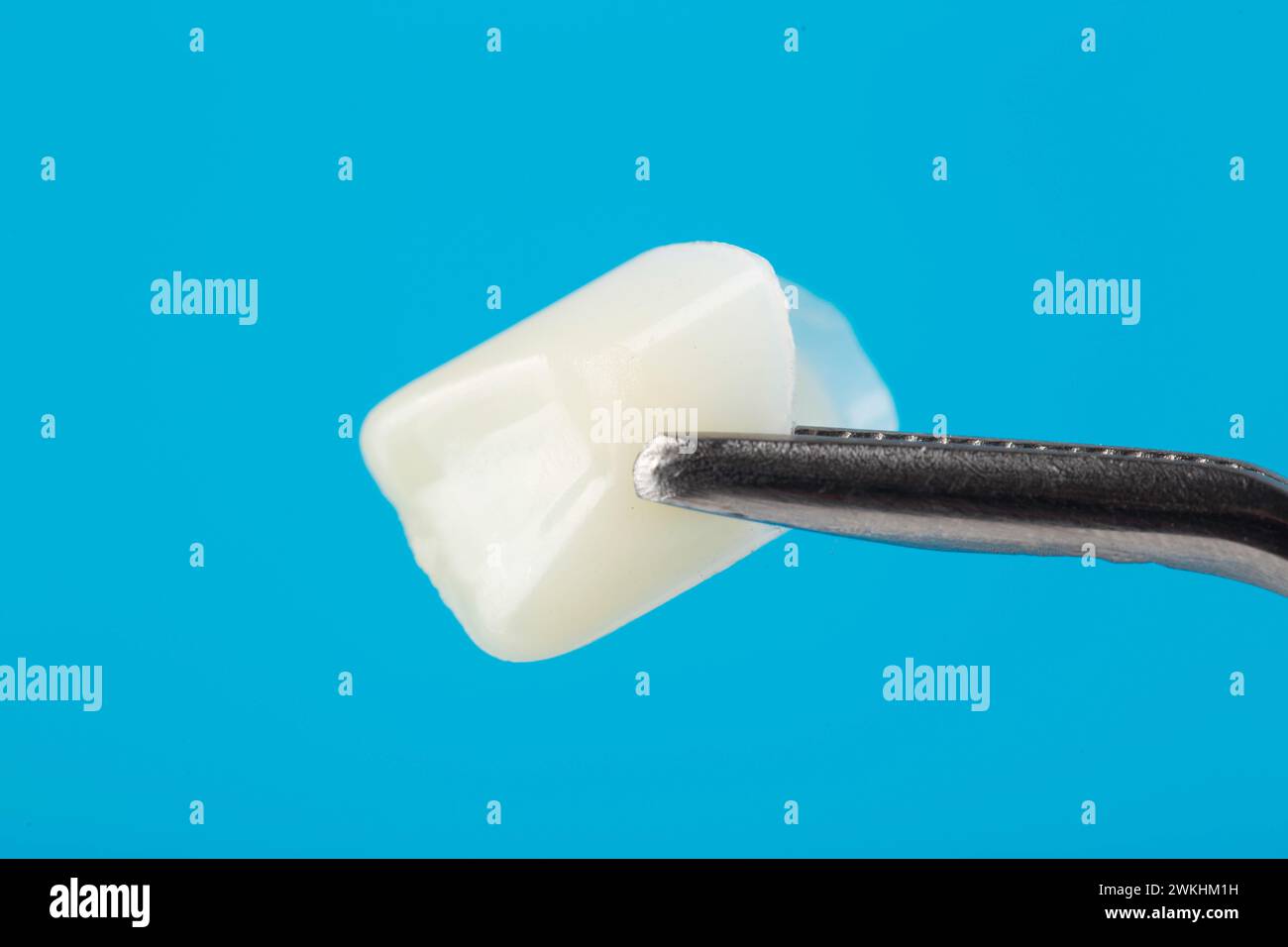 Ceramic dental crown in tweezers on a blue background, macro. The ...