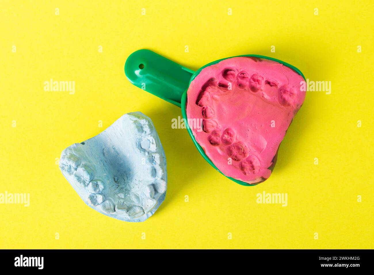 Dental alginate impression hi-res stock photography and images - Alamy