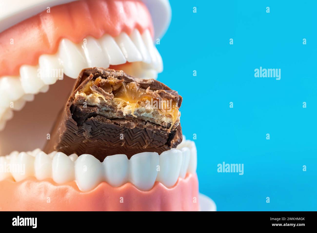 A bitten piece of chocolate in a dental jaw mockup on a blue background ...