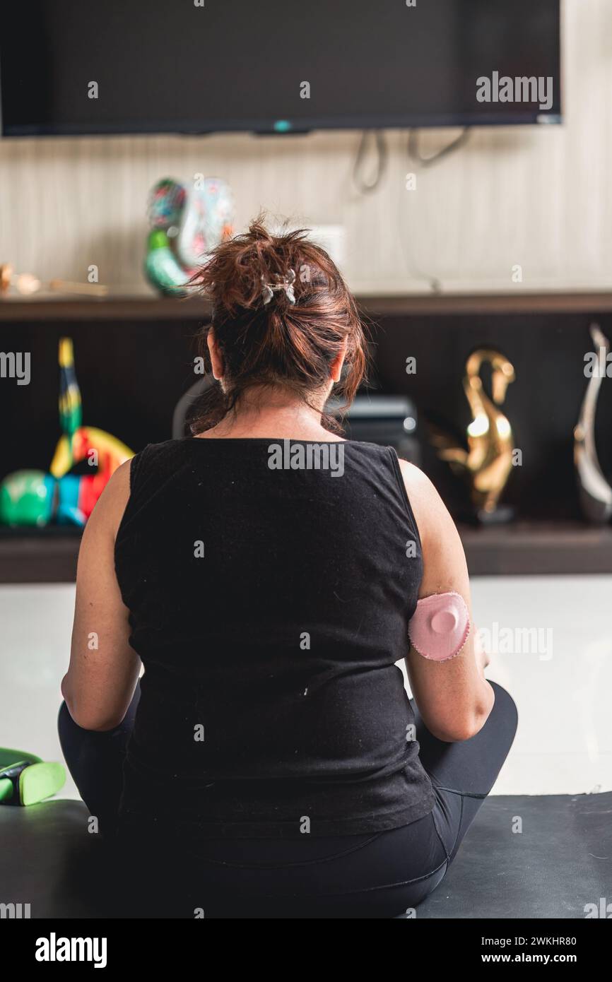 A woman with a wounded arm resting on a fitness mat Stock Photo - Alamy