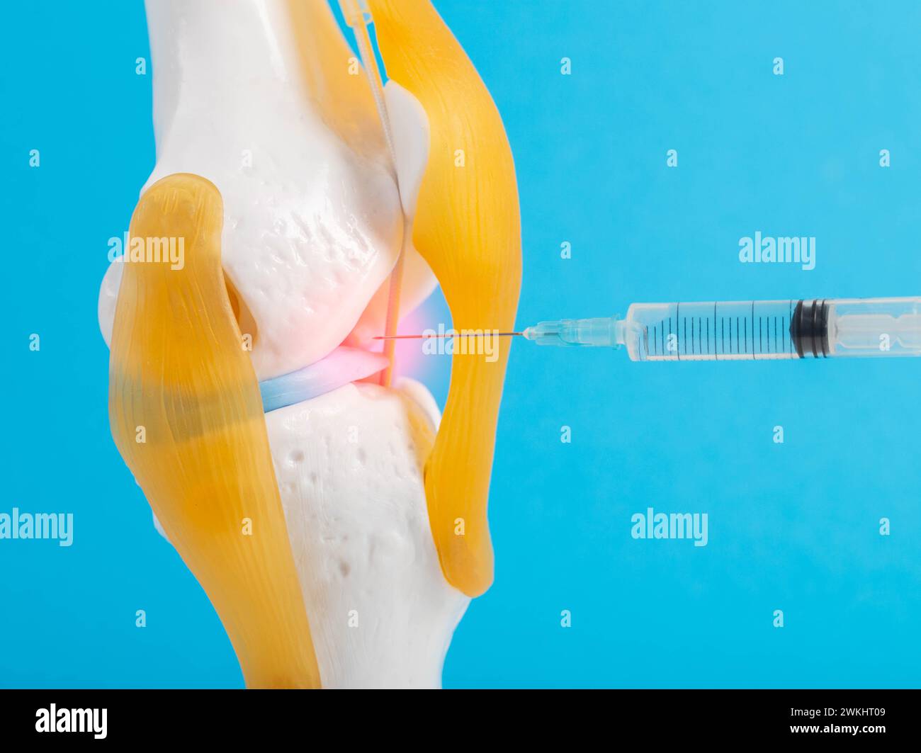 Drug blockade in a mock-up of the knee joint on a blue background. The ...