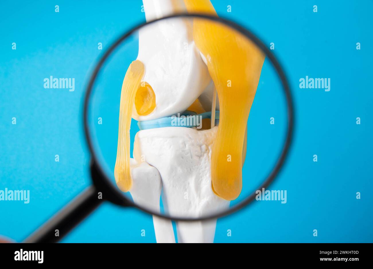 Medical mockup of a knee joint on a blue background under a magnifying ...