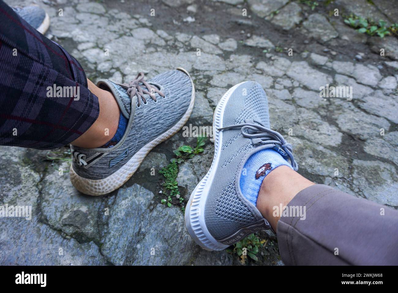 February 23, 2023, two women's feet wearing gray shoes in Wonobosobo ...