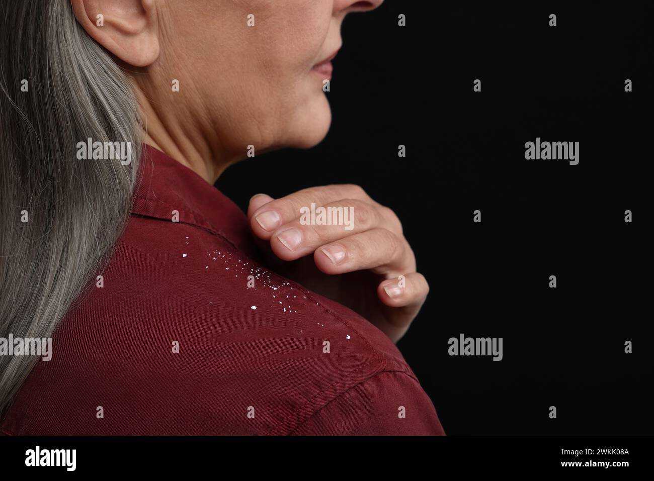Woman brushing dandruff off her shirt on black background, closeup ...