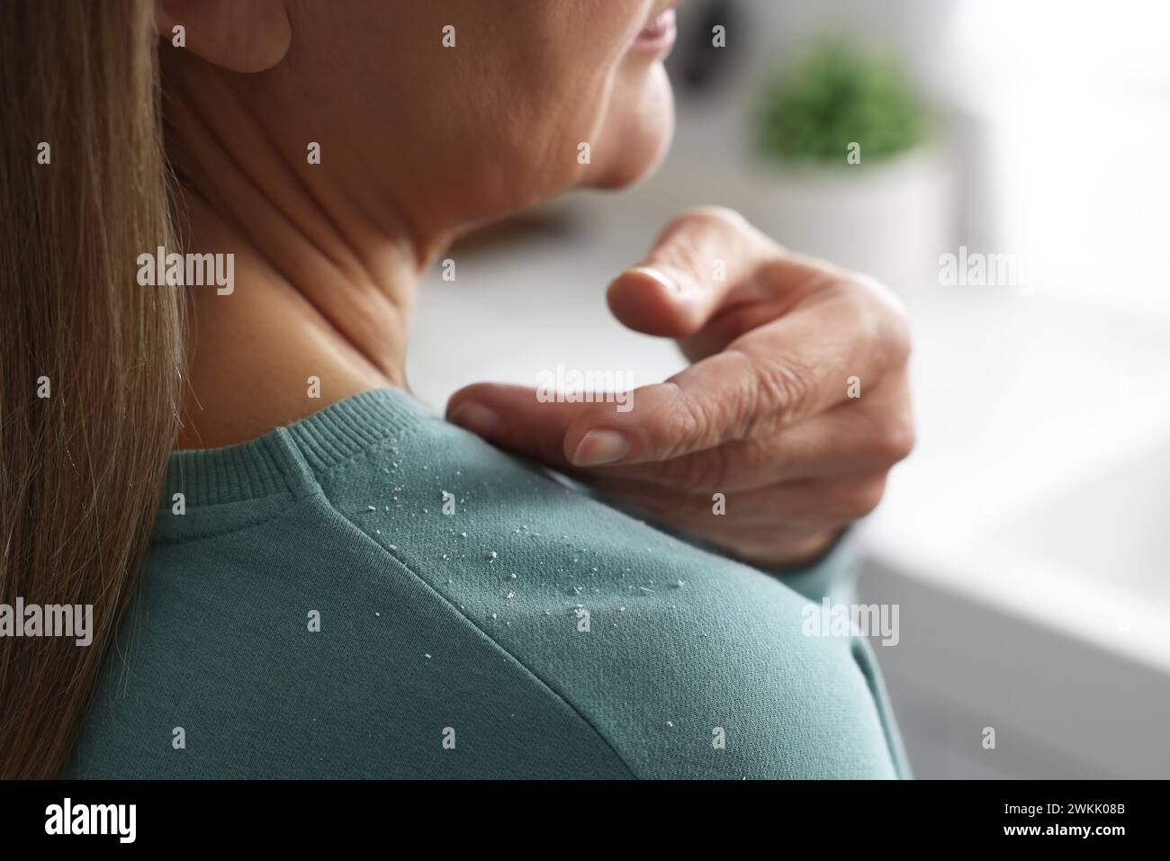 Woman brushing off skin hi-res stock photography and images - Alamy