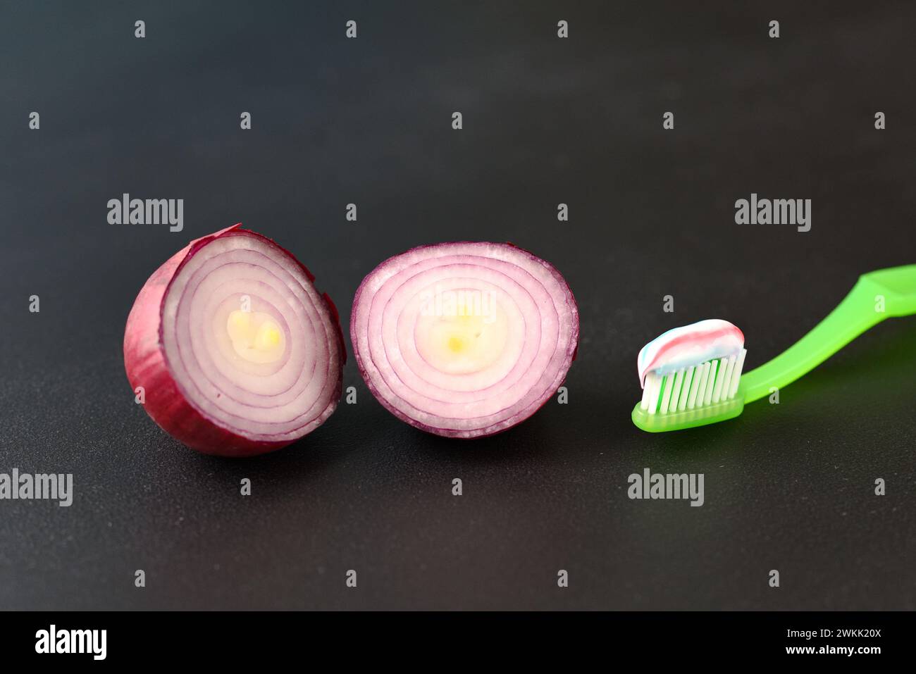Toothpaste applied to the toothbrush and red onion cut in half on dark ...