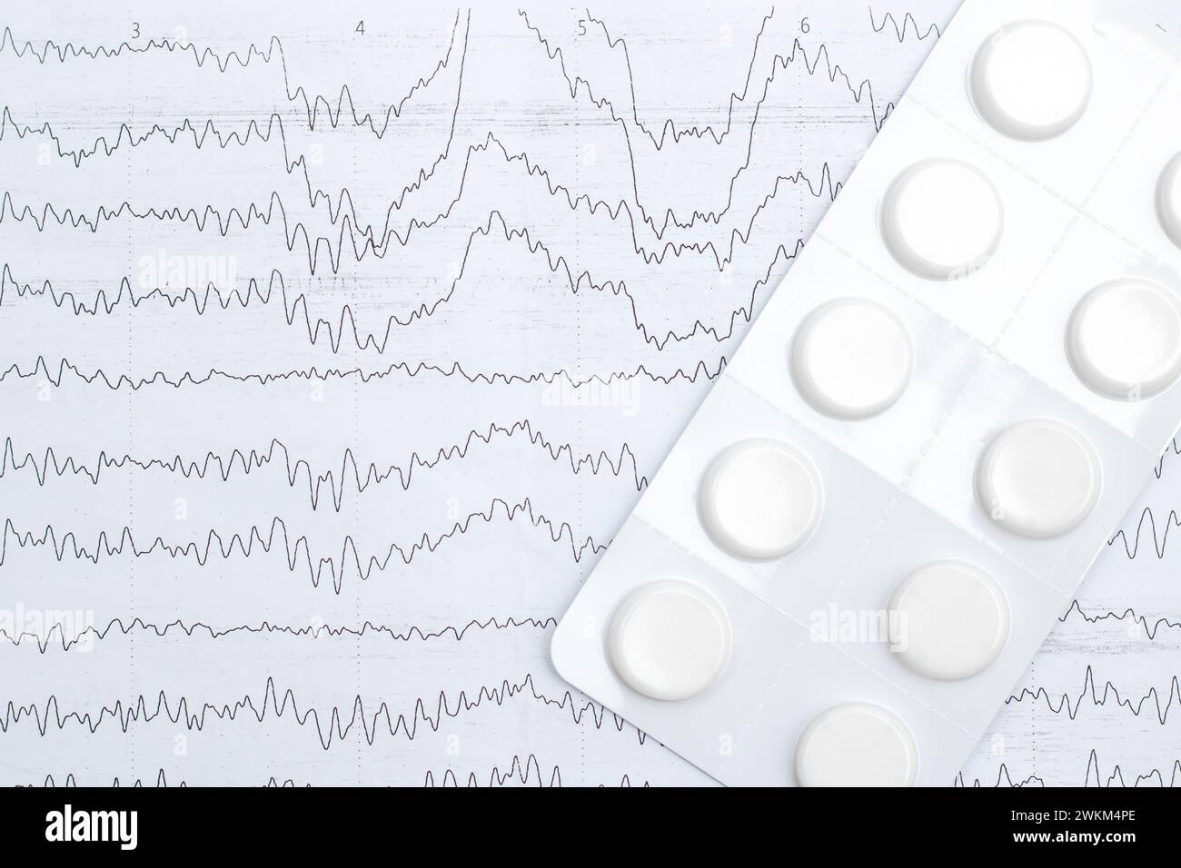 Eeg chart graph hi-res stock photography and images - Alamy