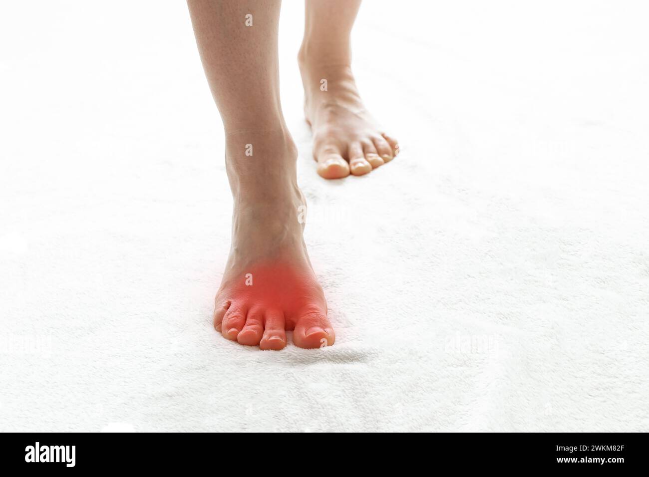 Female legs with redness where it hurts, leg pain, sore legs, health ...