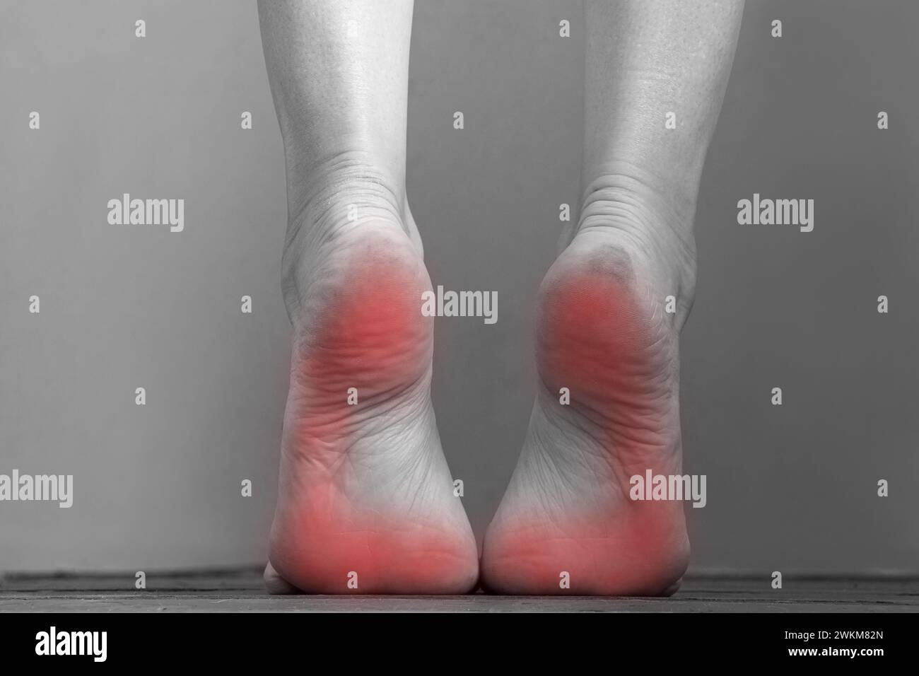 Female legs with redness where it hurts, leg pain, sore legs, health ...