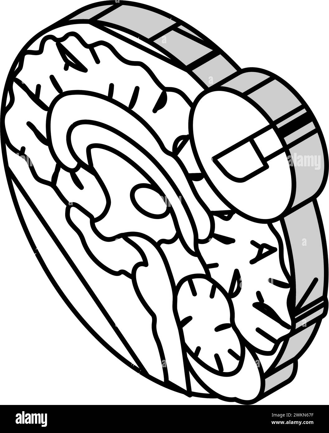 Neurology neurosurgery Black and White Stock Photos & Images - Alamy