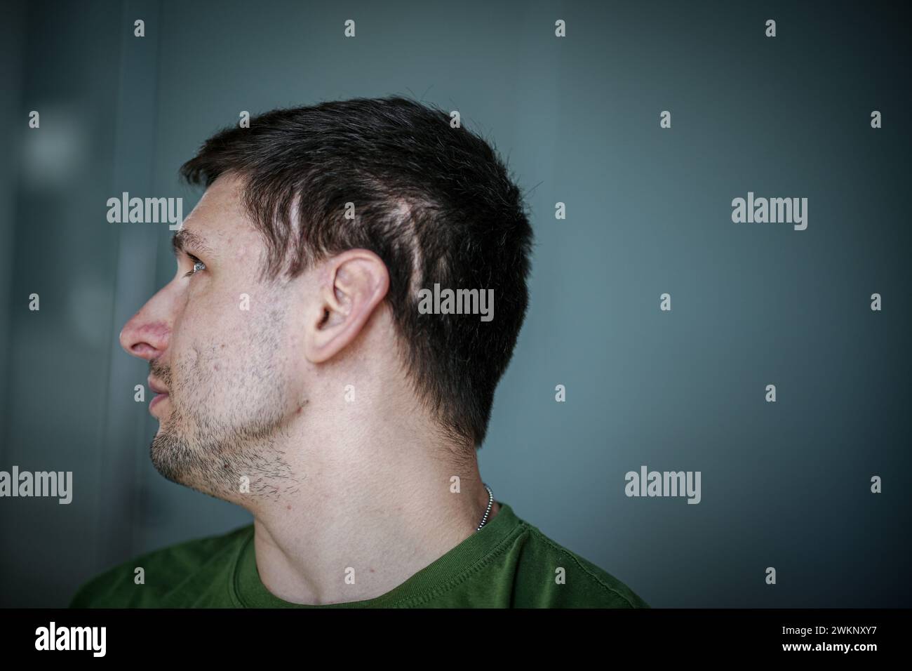 Grenade scar hi-res stock photography and images - Alamy
