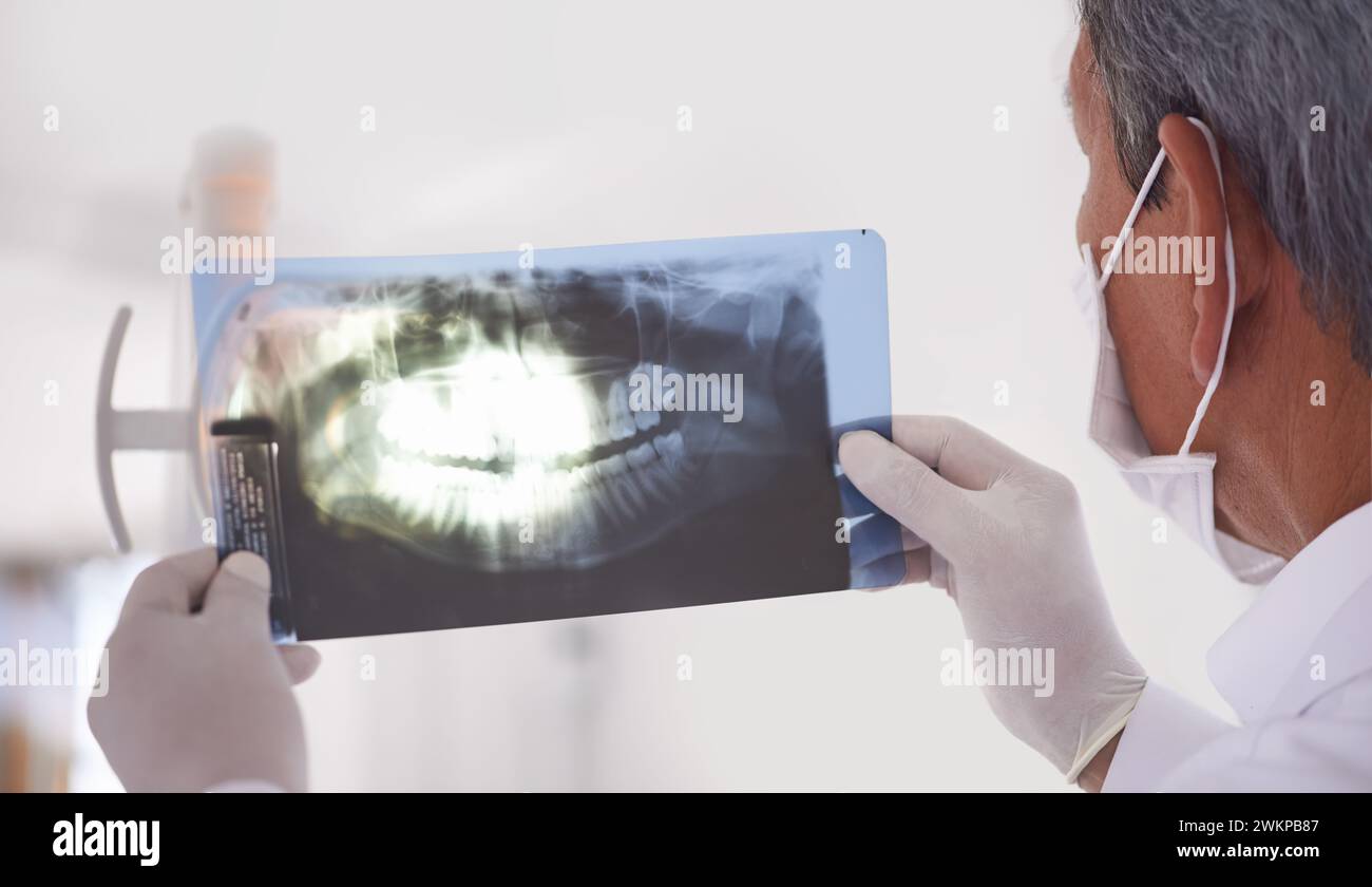 Dentist, man and xray closeup of teeth for dental surgery, healthcare ...