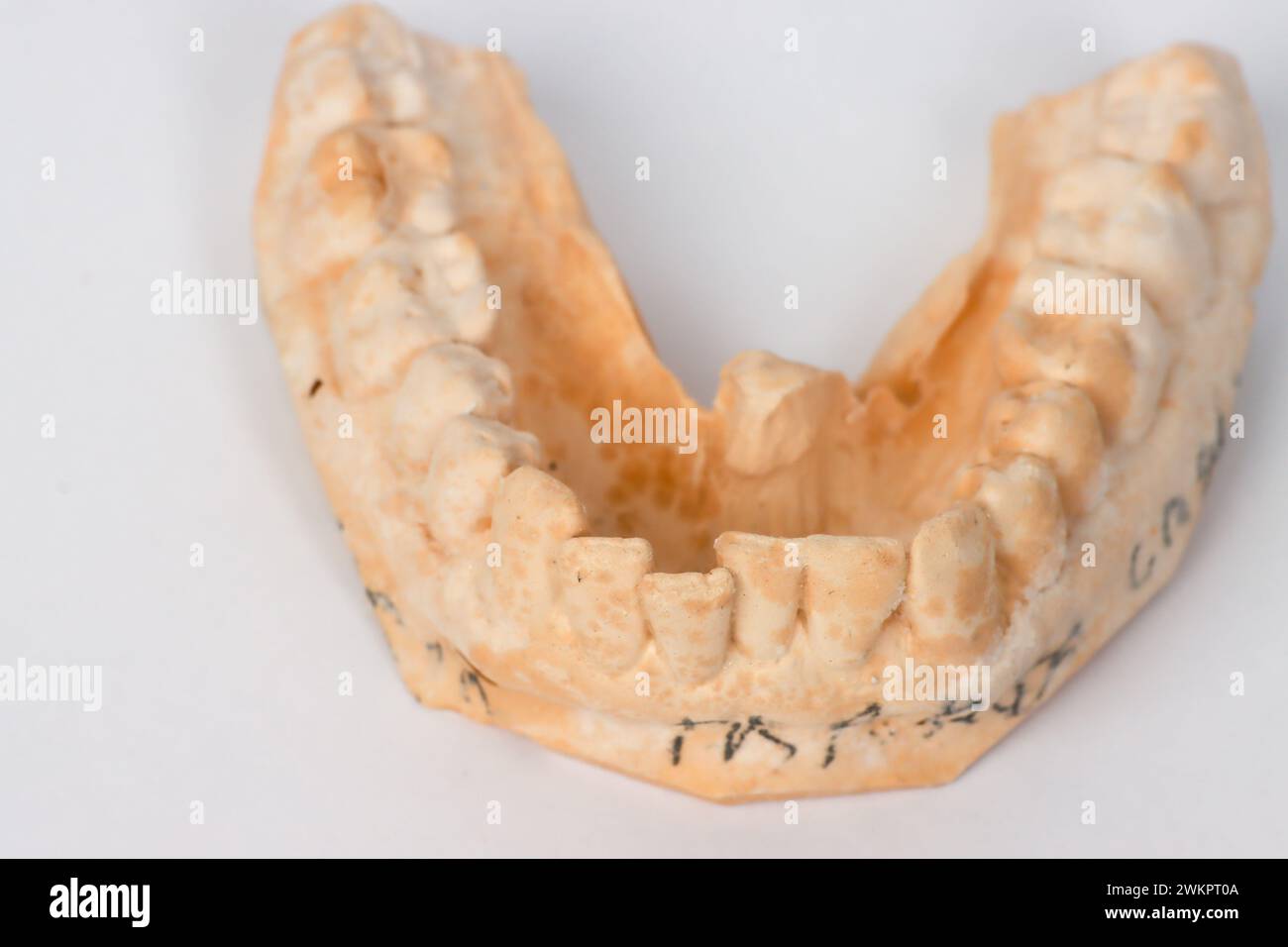 A closeup of a tooth mold on a white background Stock Photo - Alamy