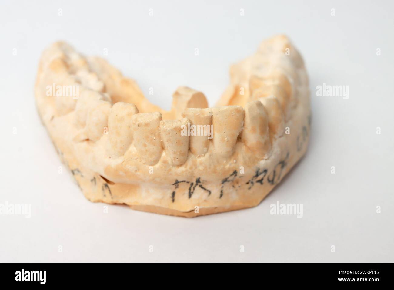 A closeup of a tooth mold on a white background Stock Photo - Alamy