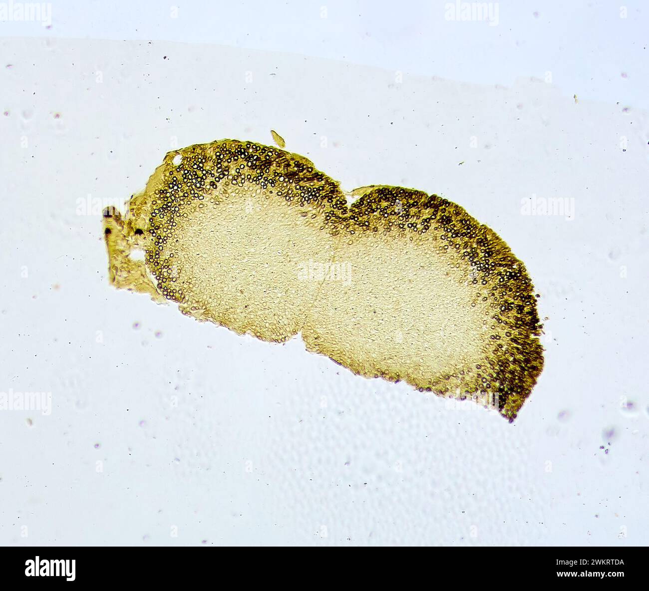 amazing inhabitants of the microworld under a microscope Stock Photo ...