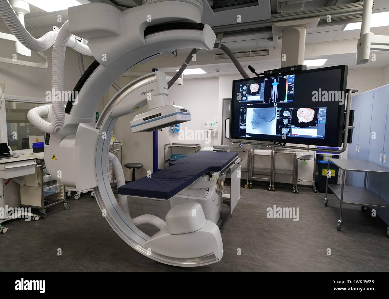 A view of the new Alphenix Sky+ system in the Interventional Room, one ...