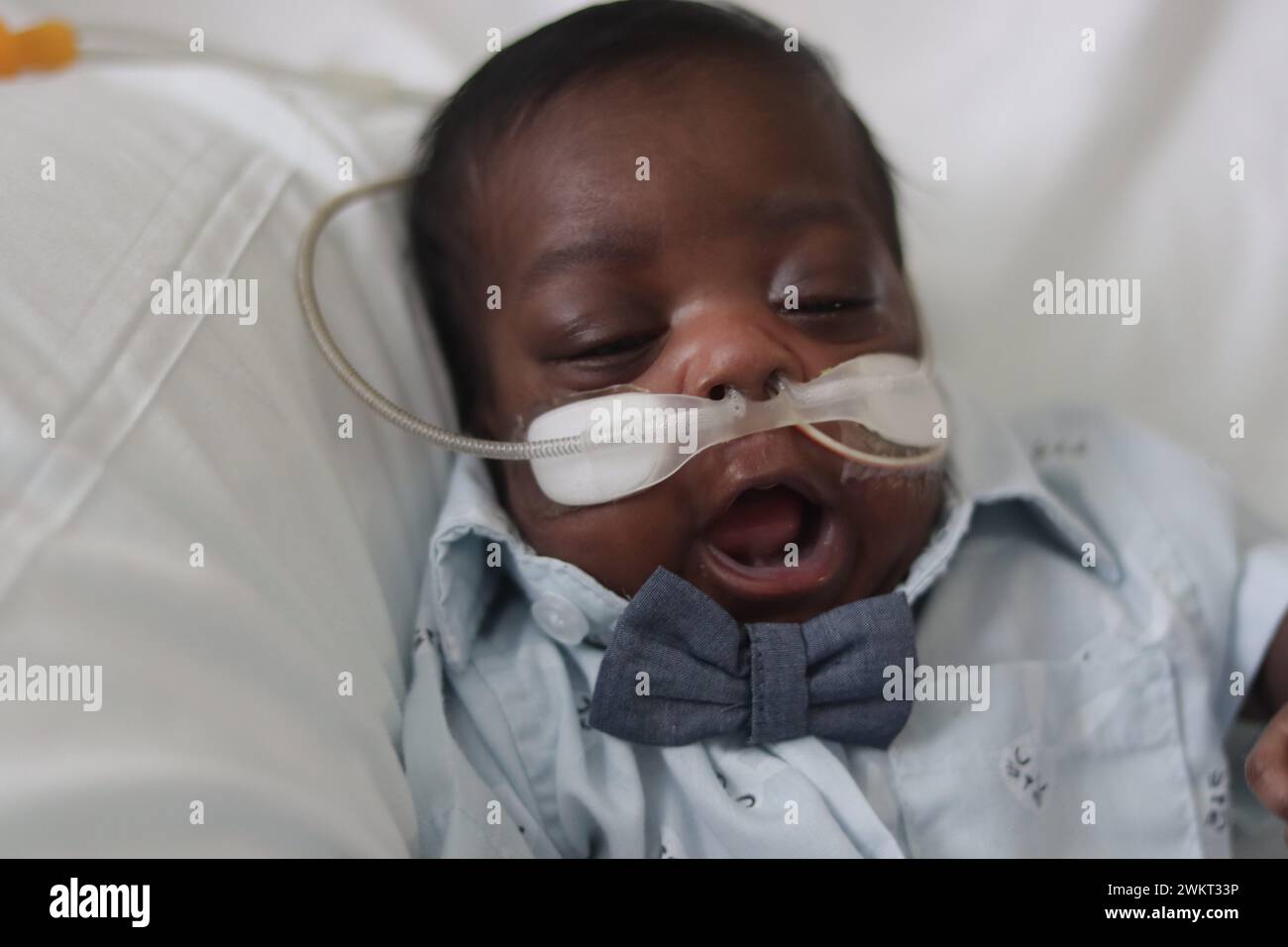 A portrait of a baby boy with a medical tube attached to his nose Stock ...