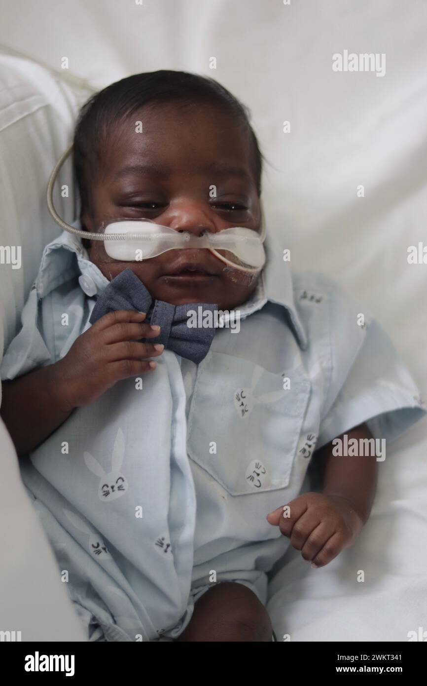 A portrait of a baby boy with a medical tube attached to his nose Stock ...