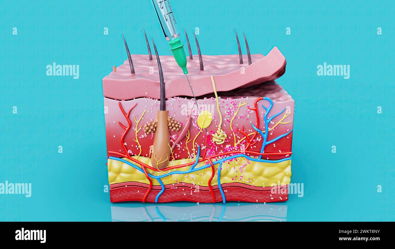 Abstract illustration of a subcutaneous injection Stock Photo - Alamy