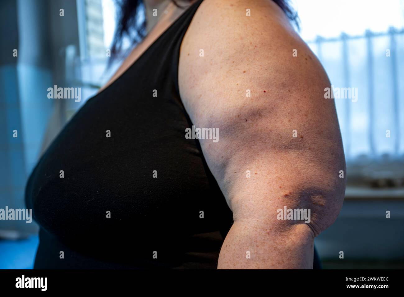 Bissendorf, Germany. 14th Feb, 2024. IILLUSTRATION A woman stands in ...