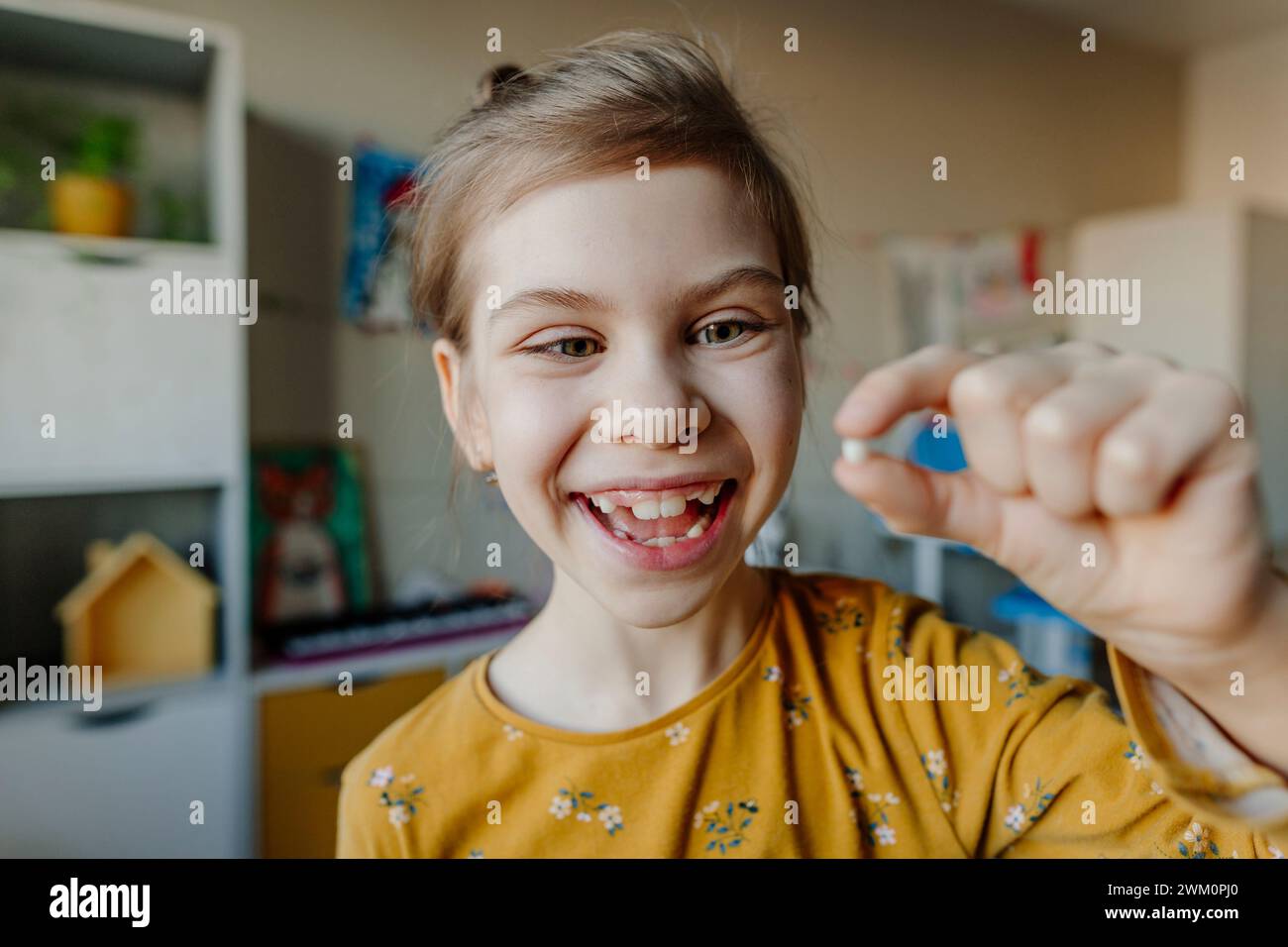 Broken tooth hi-res stock photography and images - Alamy Broken tooth hi-res stock photography and images - Alamy