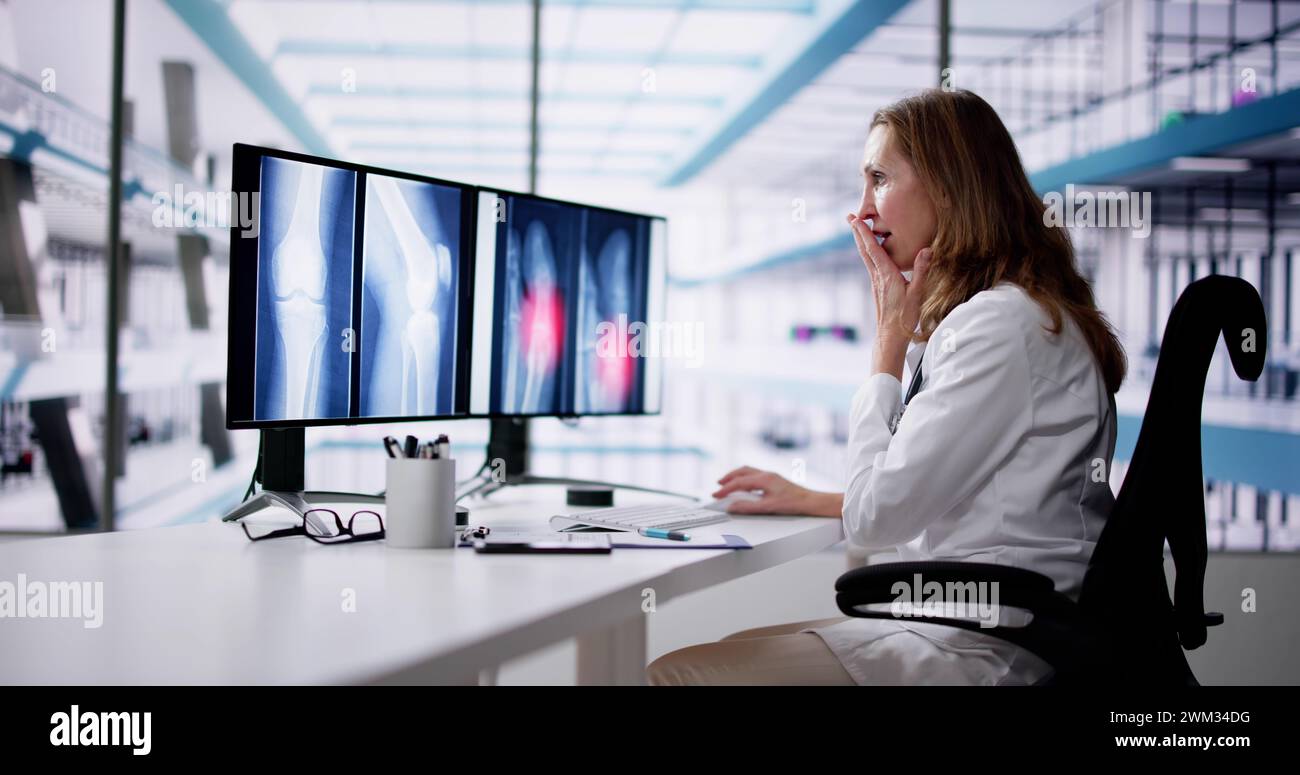 Doctor Screening Knee Bone X Ray On Computer Stock Photo - Alamy