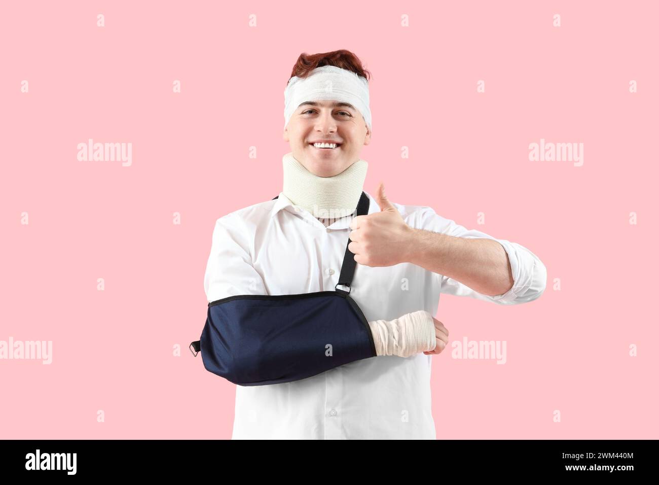 Injured young man after accident with broken arm showing thumb-up on ...