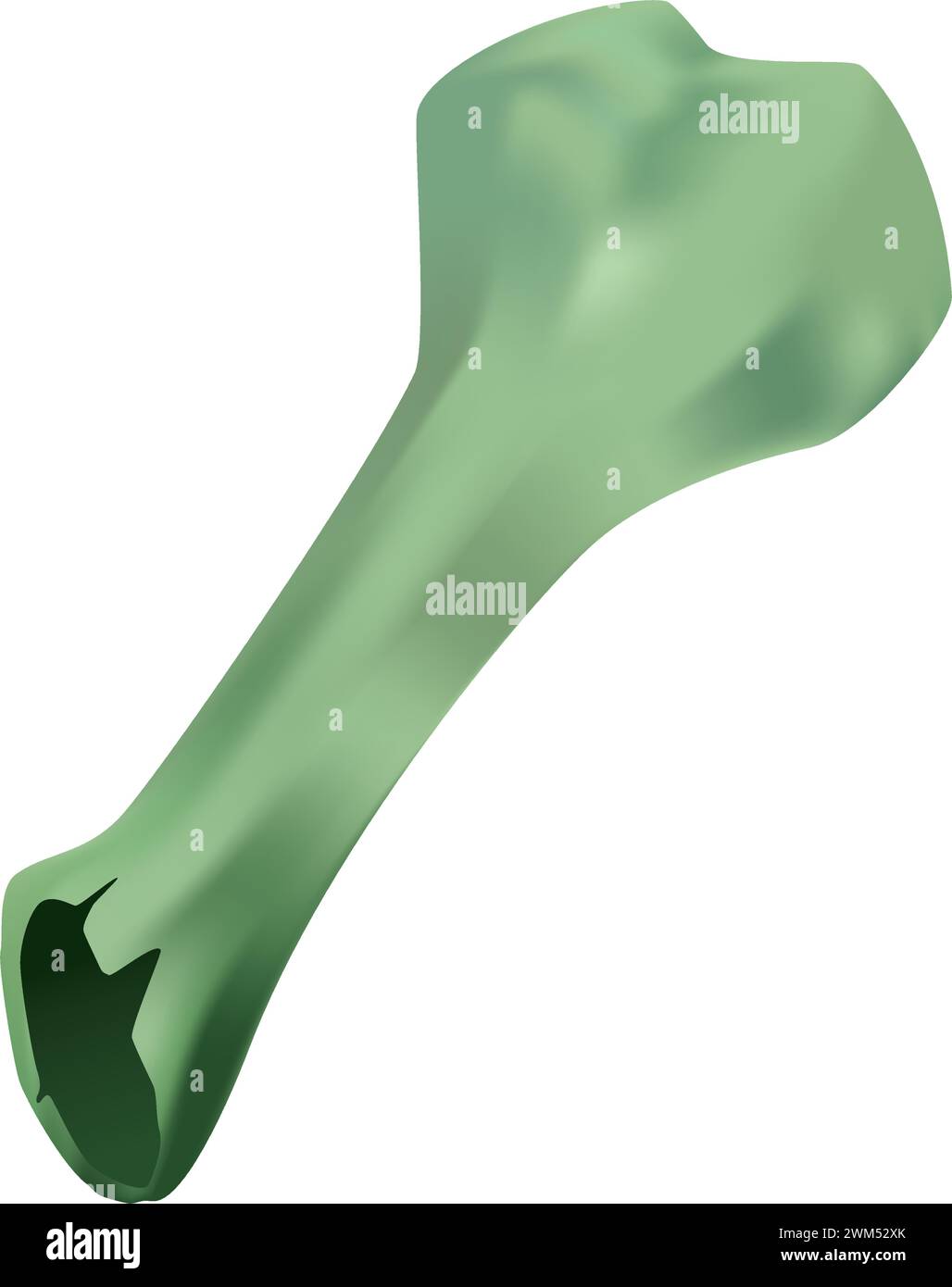 Colored detailed broken bone Vector Stock Vector Image & Art - Alamy