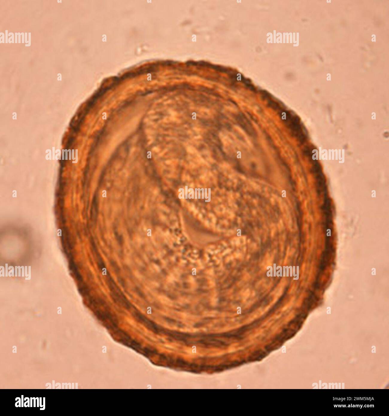 Baylisascaris procyonis egg with larva (01 Stock Photo - Alamy