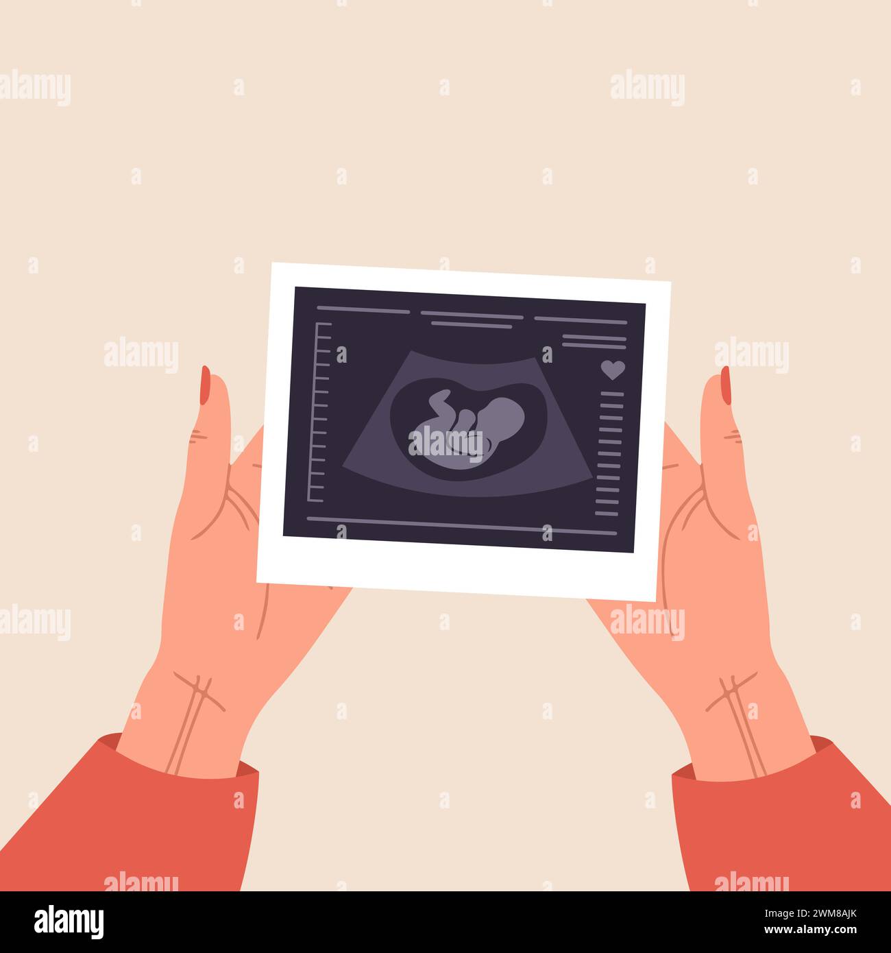 Ultrasound of baby. Female hands holding fetus silhouette photo. Embryo ...