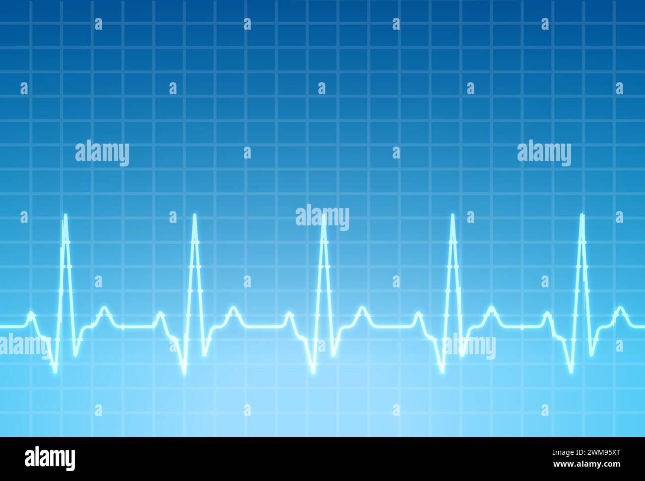 ECG heartbeat monitor, cardiogram heart pulse line wave ...
