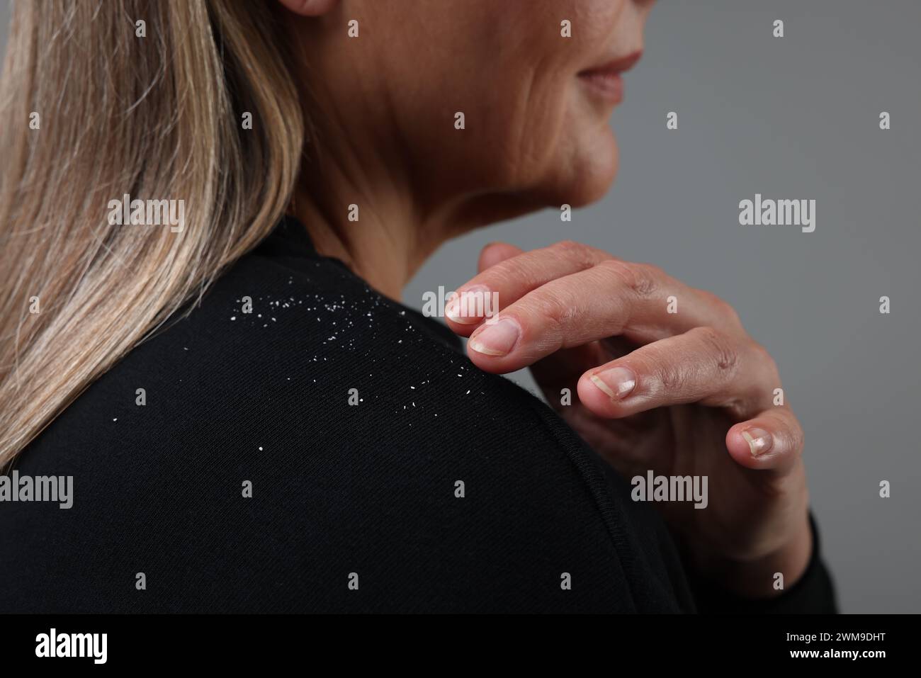 Woman brushing off skin hi-res stock photography and images - Alamy