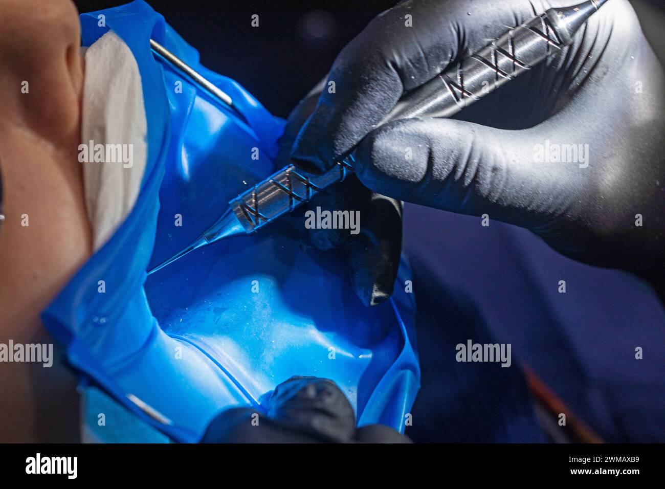 dentist uses a special instrument to restore a tooth. Dental care and ...