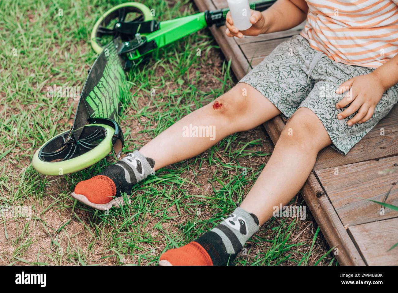 A close-up of a child's leg injury. The child injured his knee when he ...