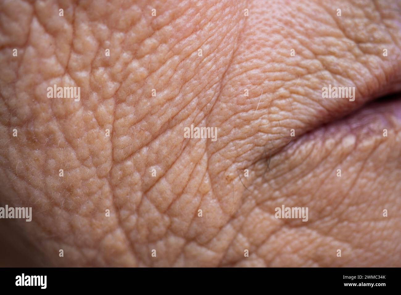 Macro photography of the detail of an elderly woman's face. Skin marked ...