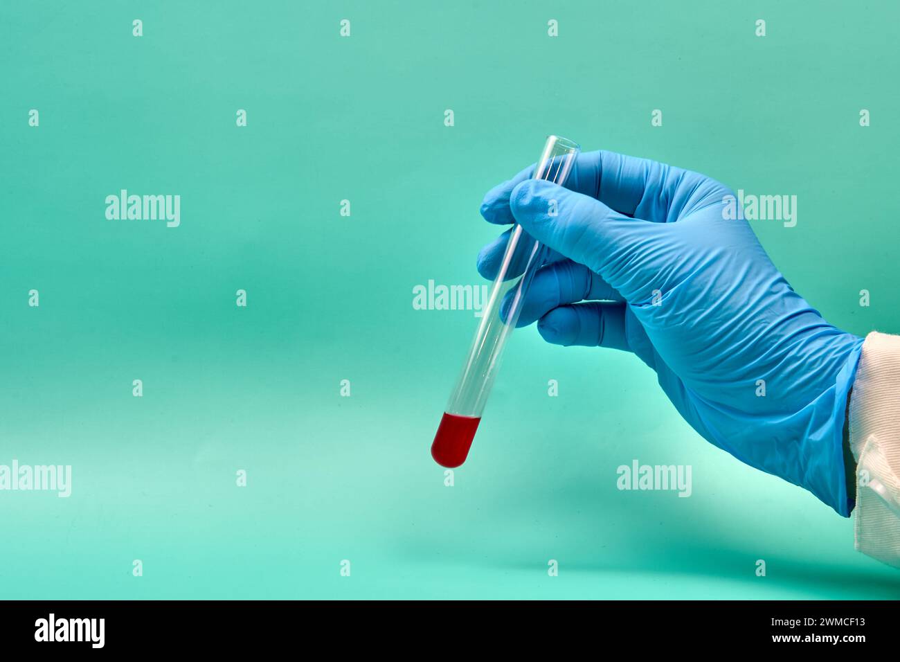 Hand of anonymous medical practitioner in blue latex glove holding test ...