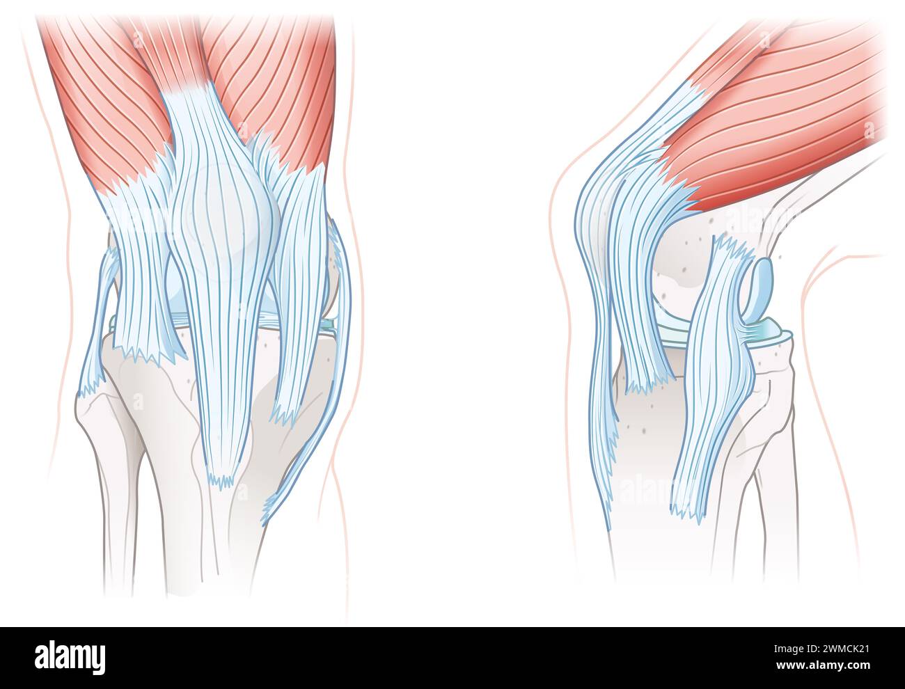 The knee joint's ligaments include the anterior cruciate ligament (ACL ...