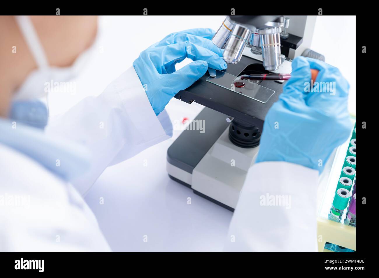 The female scientist is collecting a blood droplet to prepare for ...