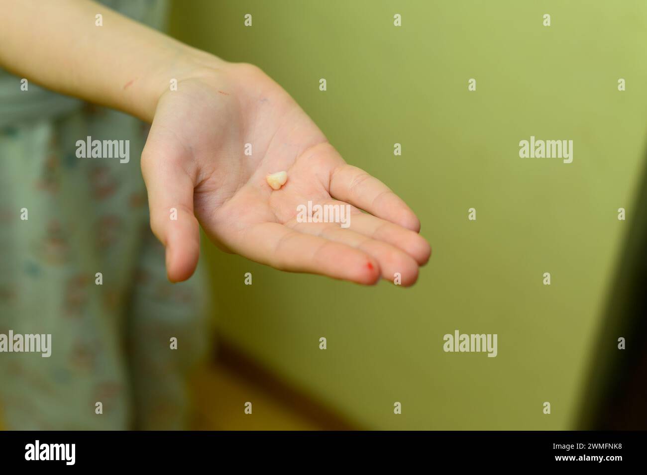 a baby tooth in a child's hand Stock Photo - Alamy