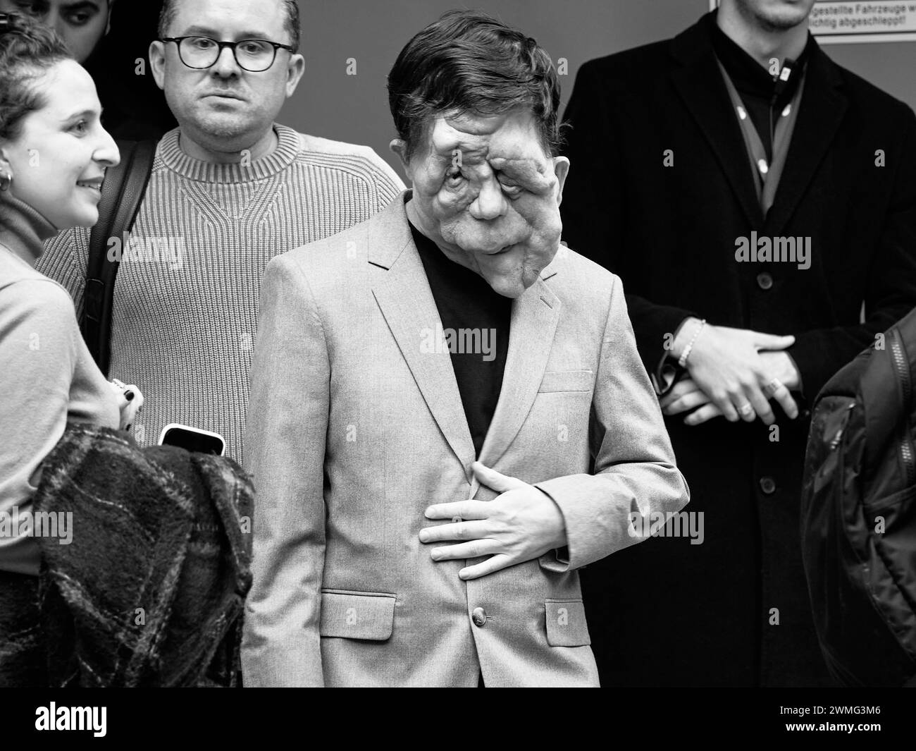 Actor adam pearson Black and White Stock Photos & Images - Alamy