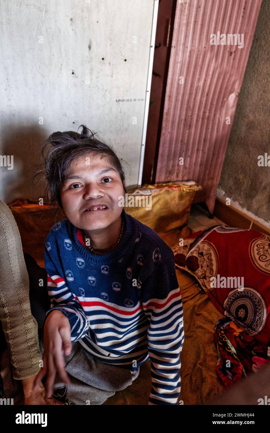 Agent Orange victims in Vietnam, dioxine pollution Stock Photo - Alamy