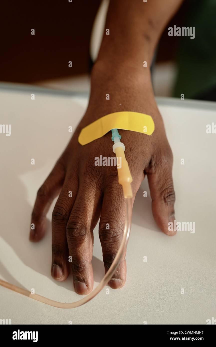 Unrecognizable male patient intravenous drip hi-res stock photography ...