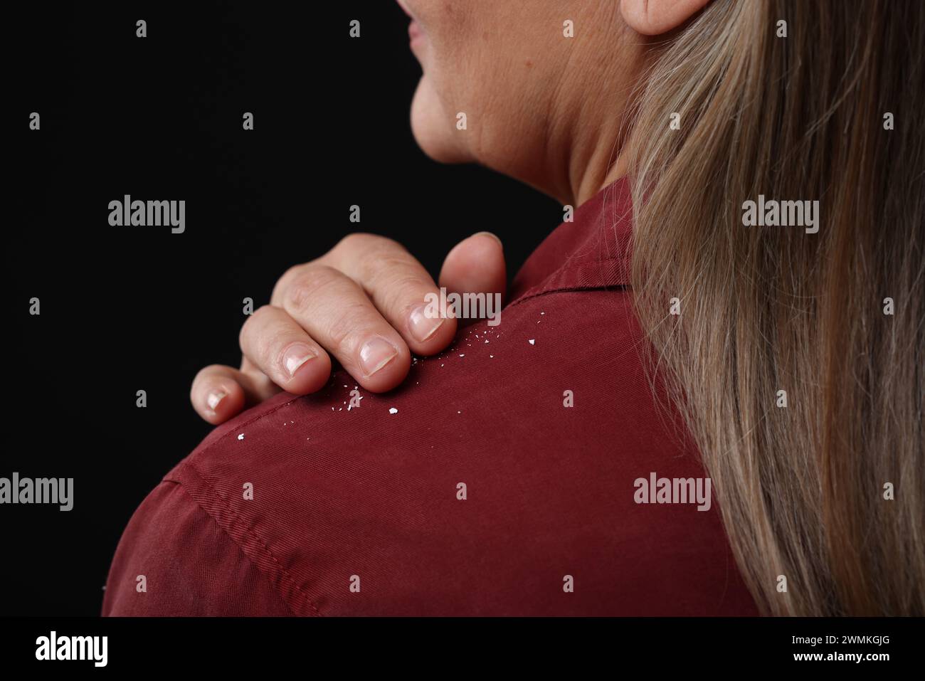 Woman brushing dandruff off her shirt on black background, closeup ...
