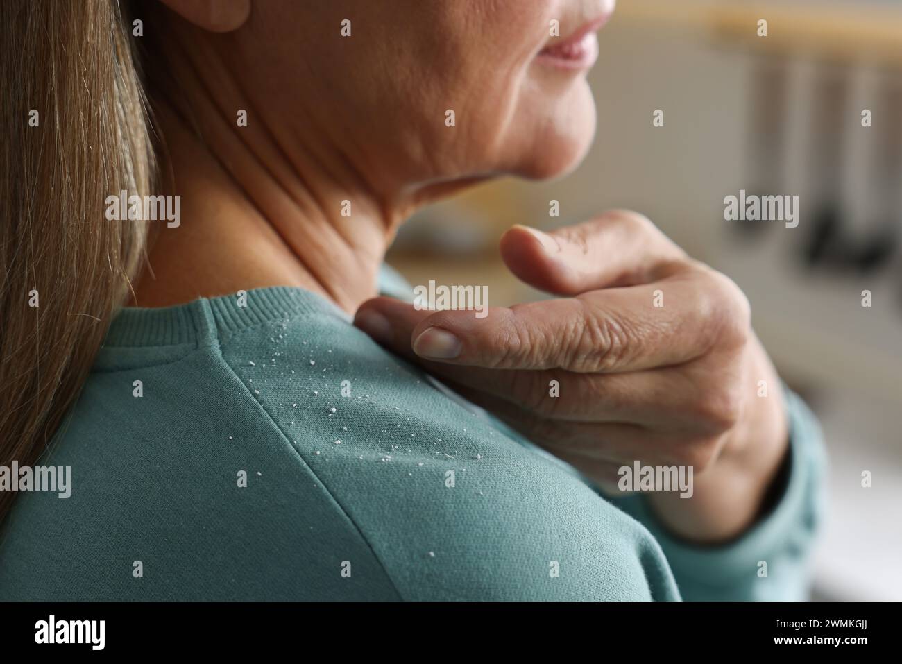 Woman brushing off skin hi-res stock photography and images - Alamy