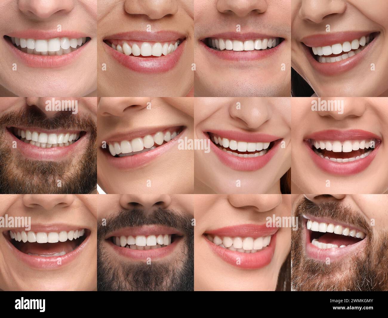 People showing white teeth, closeup. Collage of photos Stock Photo - Alamy