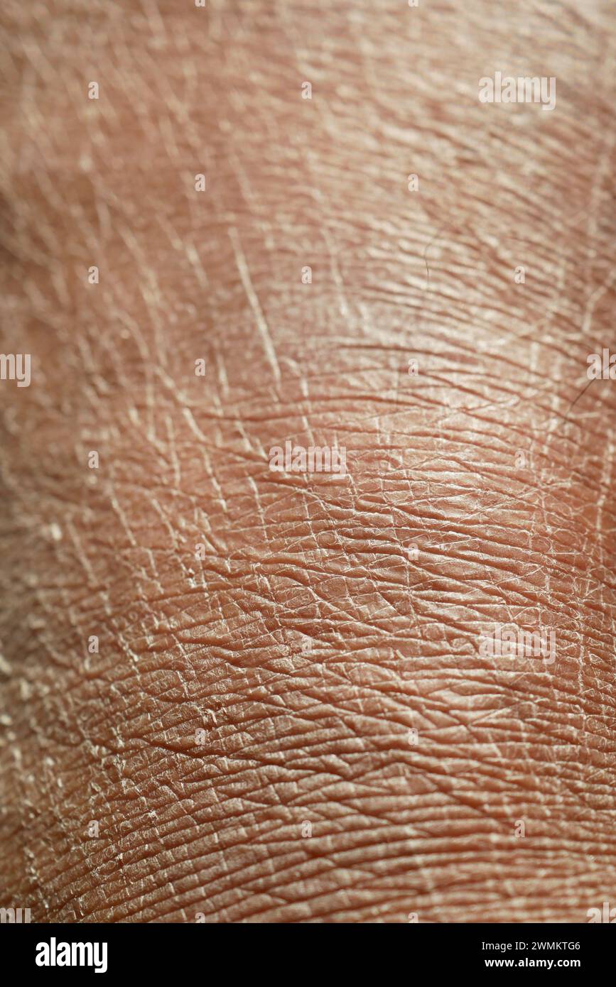 Closeup view woman normal hi-res stock photography and images - Alamy