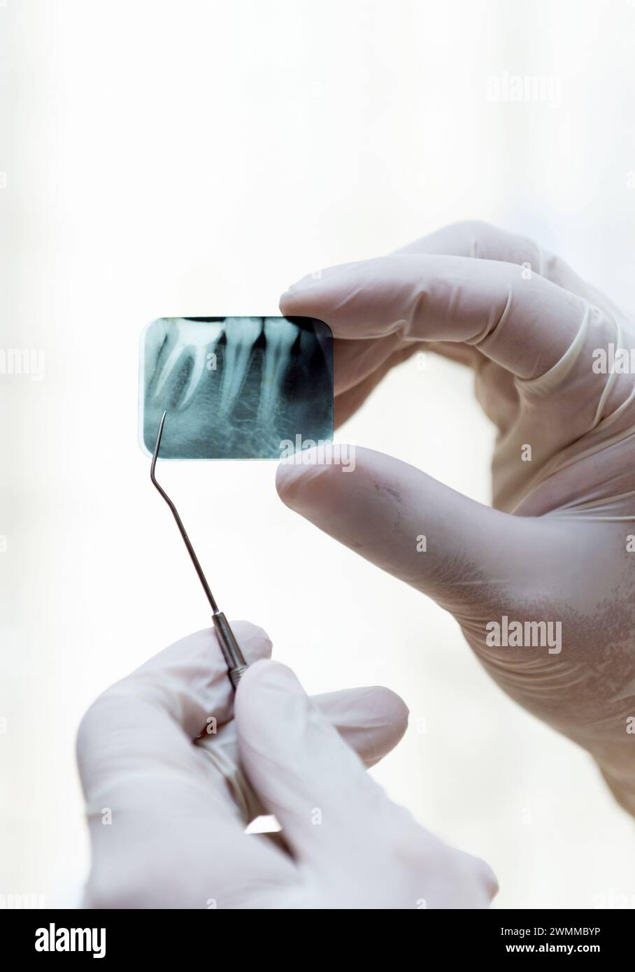 Tooth x-ray being examined by a dentist Stock Photo - Alamy