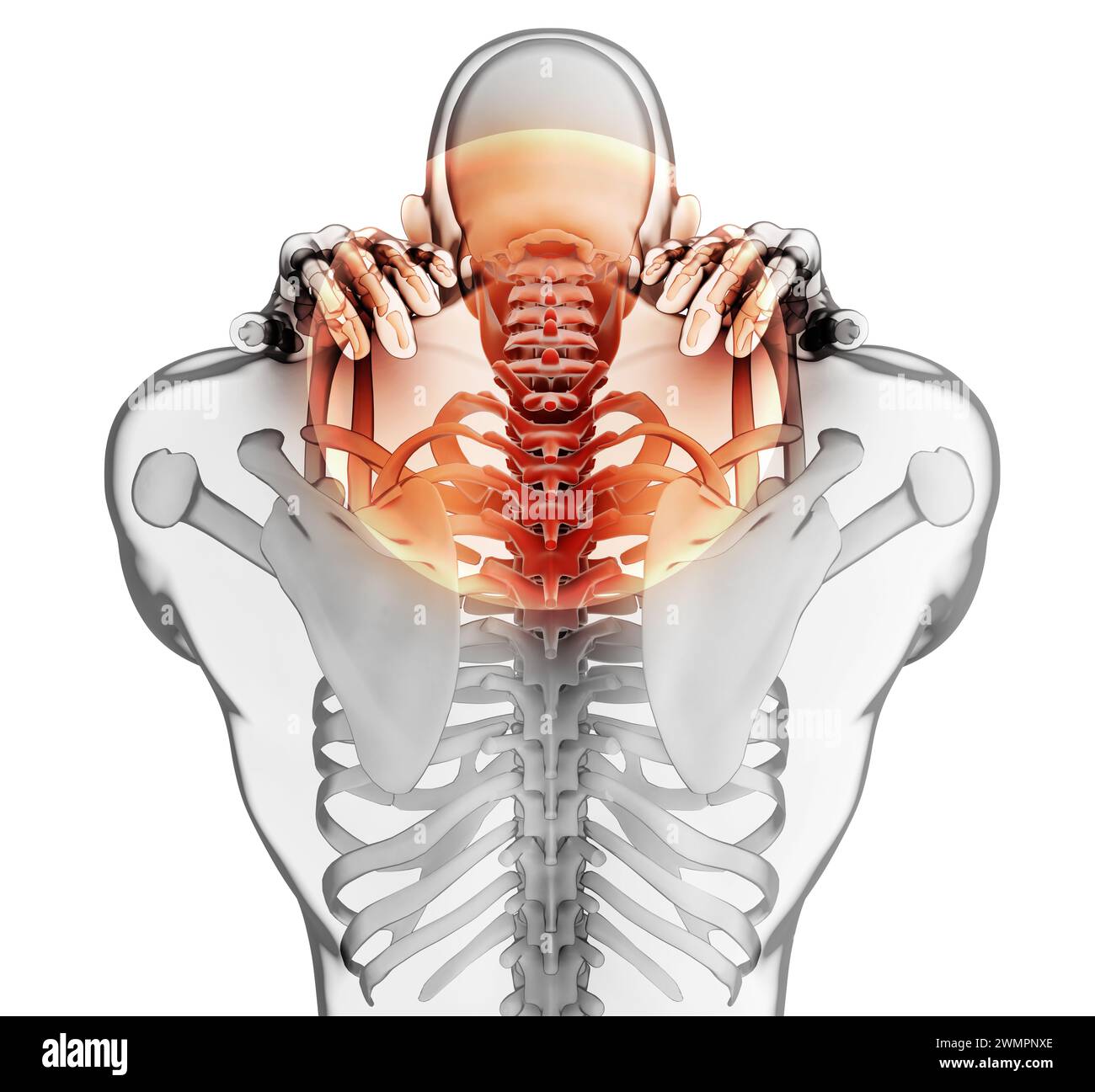 3D illustration, neck painful - cervical spine skeleton x-ray, medical ...